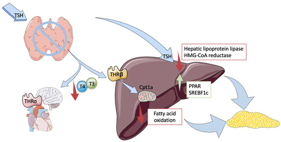 Understanding the Relationship between Nonalcoholic Fatty Liver Disease ...