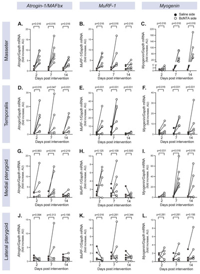 Unilateral Hypofunction of the Masseter Leads to Molecular and 3D ...