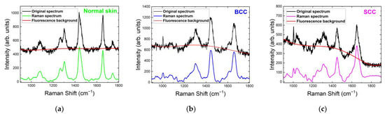 Multispectral Raman Differentiation of Malignant Skin Neoplasms In ...