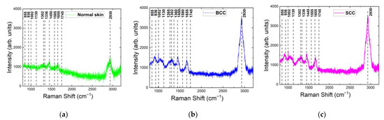 Multispectral Raman Differentiation of Malignant Skin Neoplasms In ...