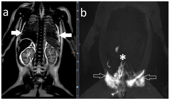 Non-Contrast MR Lymphography and Intranodal Dynamic Contrast MR ...