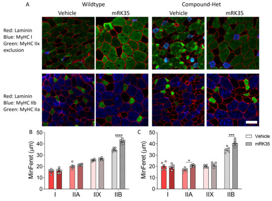 Pharmacological Inhibition of Myostatin in a Mouse Model of Typical ...