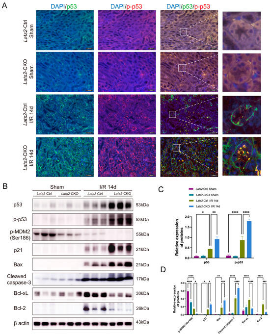 Proximal Tubular Lats2 Ablation Exacerbates Ischemia/Reperfusion Injury ...
