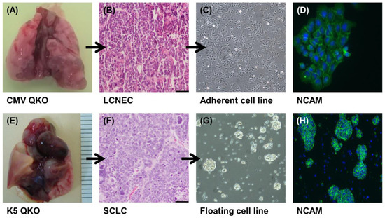 Novel Mouse Cell Lines and In Vivo Models for Human High-Grade Neuroendocrine Lung Carcinoma ...