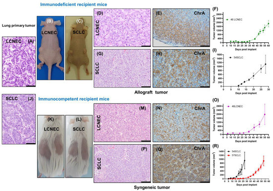 Novel Mouse Cell Lines and In Vivo Models for Human High-Grade ...