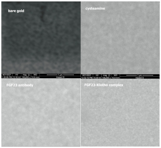 IJMS | Free Full-Text | A New Approach to the Quantification of ...