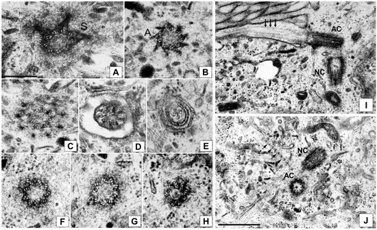 The Endothelial Centrosome: Specific Features and Functional ...