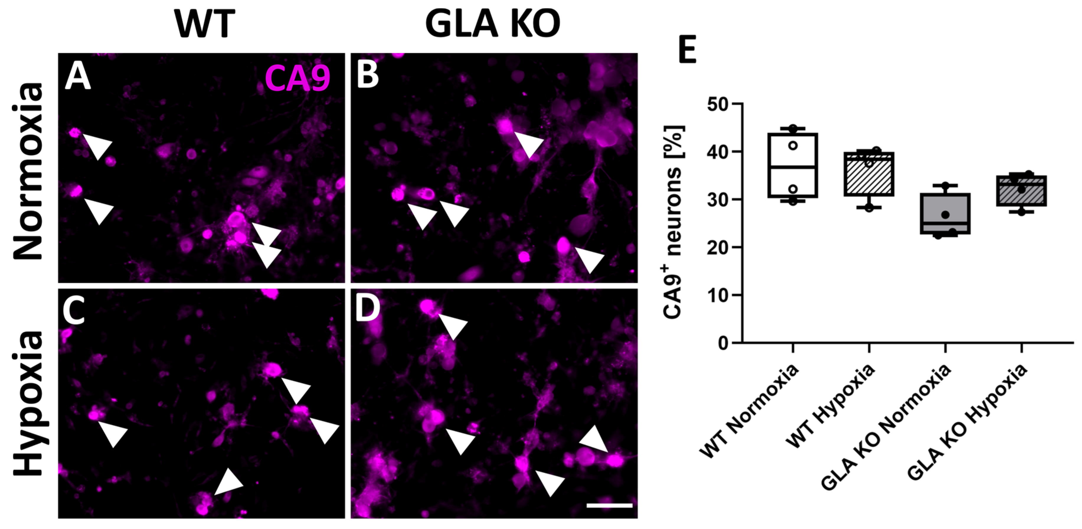 Endothelial Cell Dysfunction and Hypoxia as Potential Mediators of Pain ...