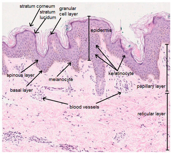 IJMS | Free Full-Text | Plant Extracts as Skin Care and Therapeutic Agents