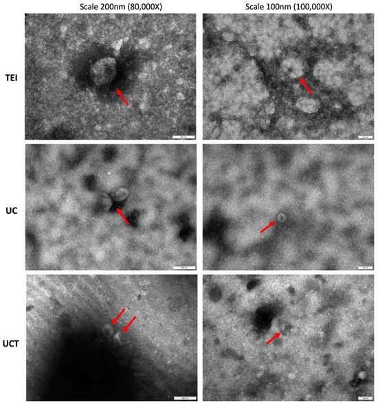 Comparison Study of Small Extracellular Vesicle Isolation Methods for ...