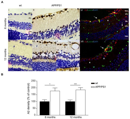 IJMS | Free Full-Text | Altered Clock Gene Expression in Female APP/PS1 Mice and Aquaporin ...