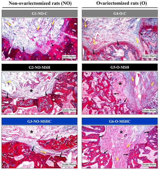 Viability of Collagen Matrix Grafts Associated with Nanohydroxyapatite ...