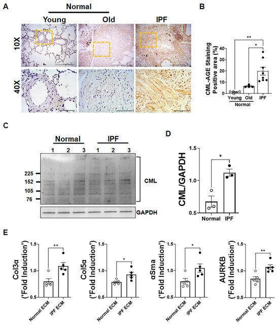 Nε-Carboxymethyl-Lysine Modification of Extracellular Matrix Proteins ...
