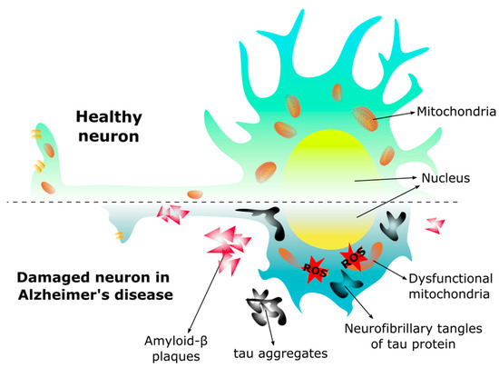 IJMS | Free Full-Text | Potential Retinal Biomarkers in Alzheimer’s Disease