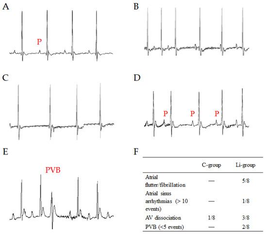 Lithium Treatment Induces Cardiac Dysfunction in Mice