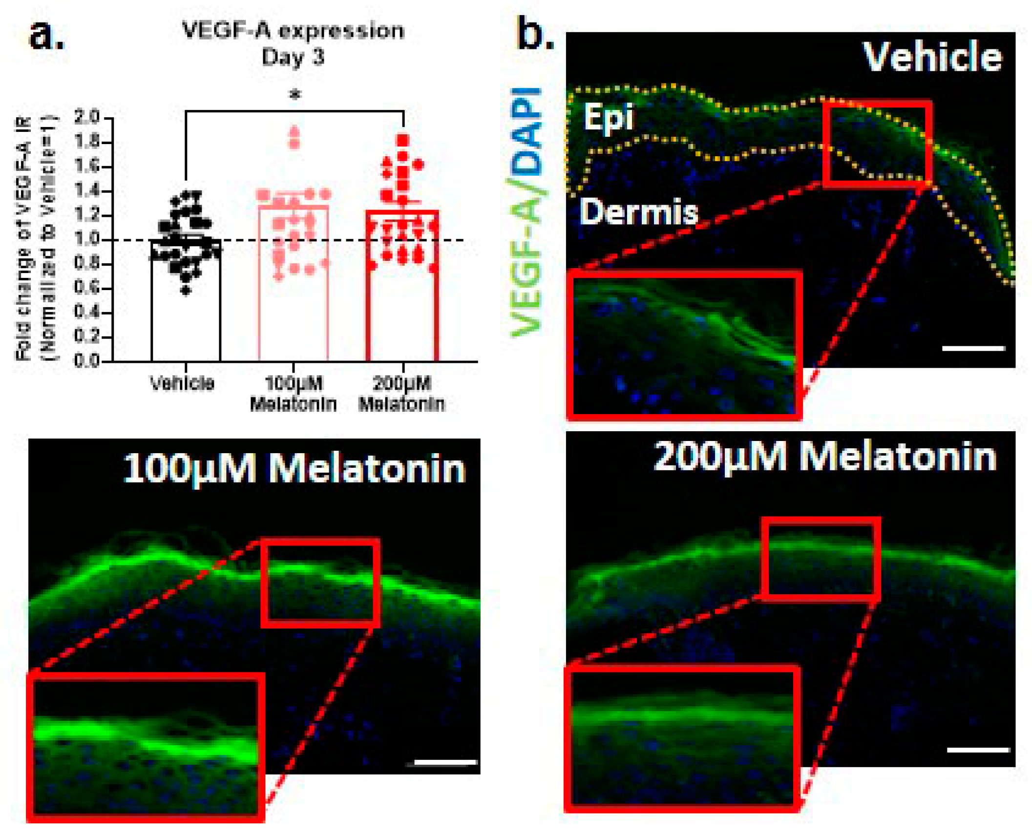 IJMS | Free Full-Text | Melatonin Exerts Prominent, Differential ...