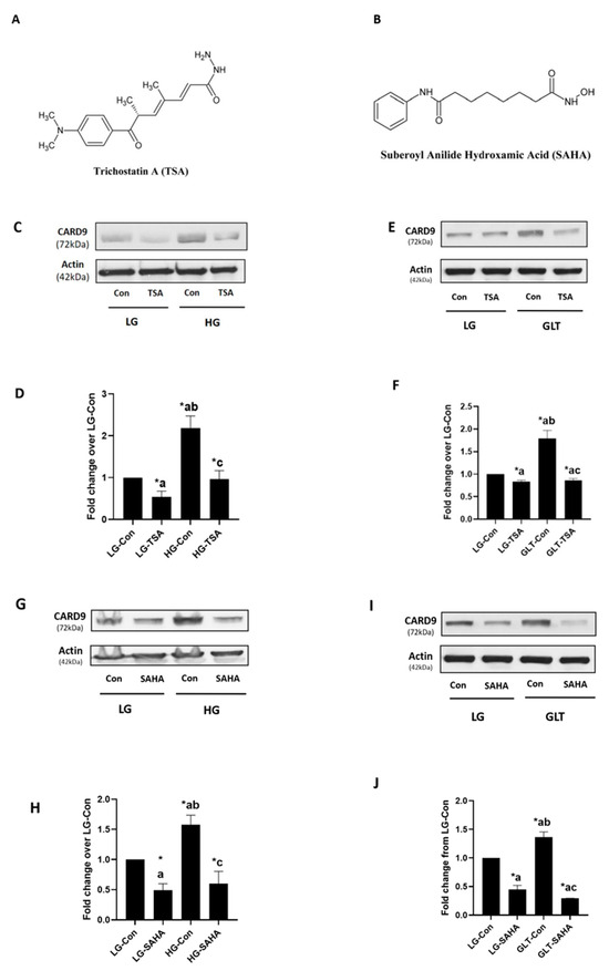 IJMS | Free Full-Text | Regulatory Roles of Histone Deacetylation in ...