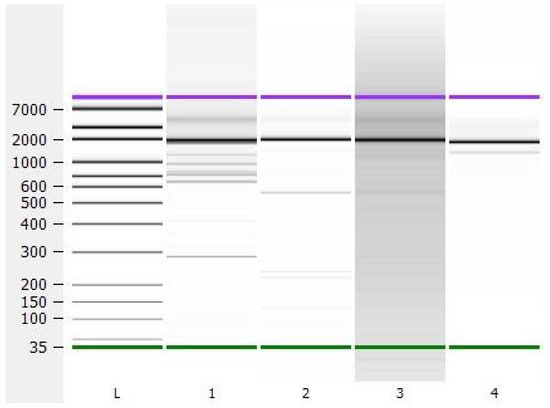 The Modification of the Illumina® CovidSeq™ Workflow for RSV Genomic ...