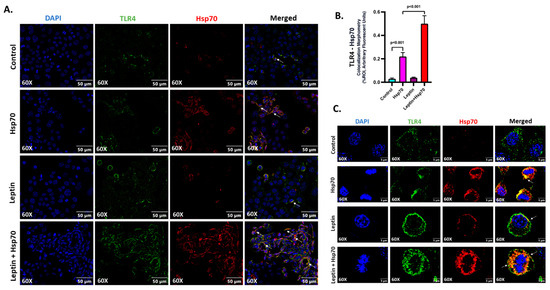 IJMS | Free Full-Text | Hepatic NLRP3-Derived Hsp70 Binding to TLR4 ...