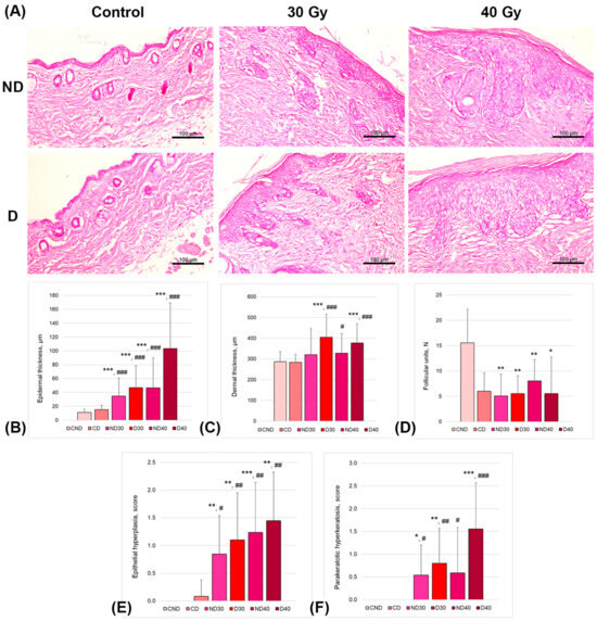 An Experimental Model of Proton-Beam-Induced Radiation Dermatitis In Vivo