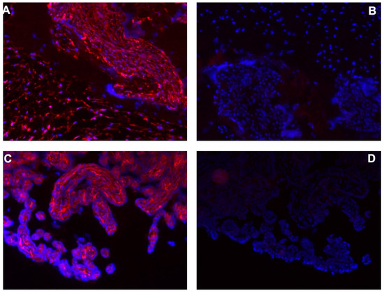 Regulation of Immune Checkpoint Antigen CD276 (B7-H3) on Human Placenta ...