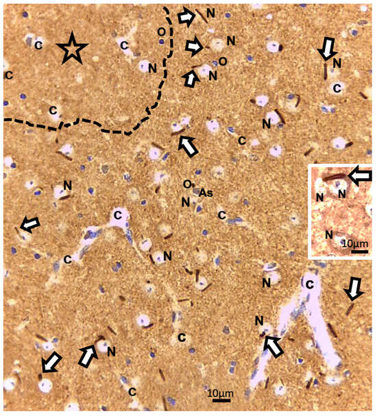 IJMS | Free Full-Text | Thalamic Neuron Resilience during Osmotic ...