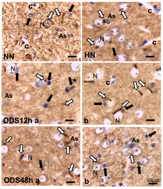 IJMS | Free Full-Text | Thalamic Neuron Resilience during Osmotic ...