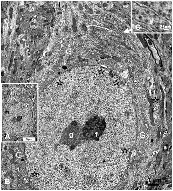 IJMS | Free Full-Text | Thalamic Neuron Resilience during Osmotic ...