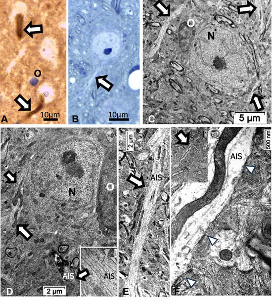 IJMS | Free Full-Text | Thalamic Neuron Resilience during Osmotic ...