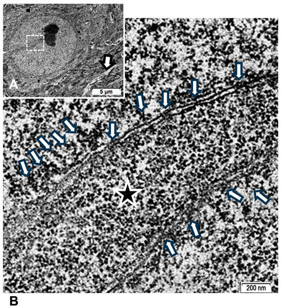 IJMS | Free Full-Text | Thalamic Neuron Resilience during Osmotic ...