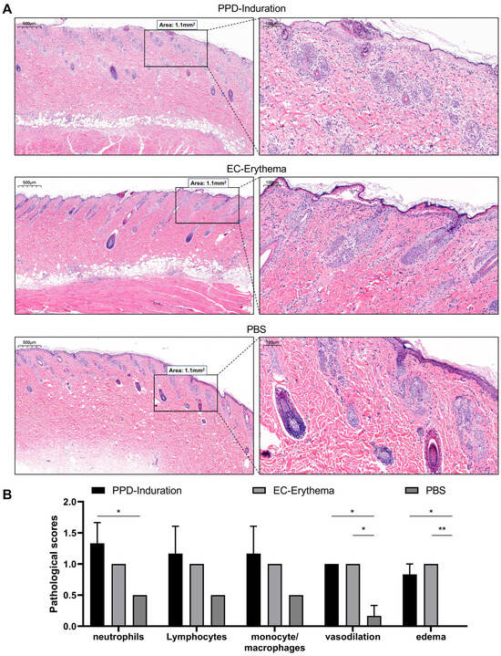 A Comparative Study on the Mechanism of Delayed-Type Hypersensitivity ...
