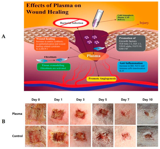 Cold Atmospheric Pressure Plasma: A Growing Paradigm in Diabetic Wound ...