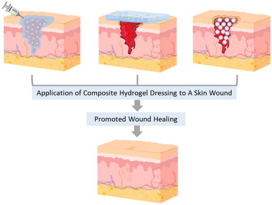 Nature-Derived Polysaccharide-Based Composite Hydrogels for Promoting ...