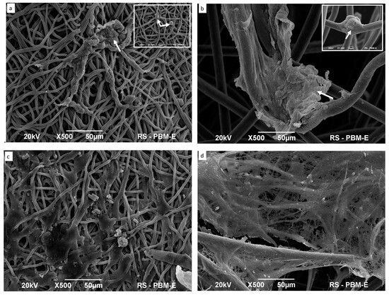 Osteogenic Potential of Human Dental Pulp Stem Cells (hDPSCs) Growing ...