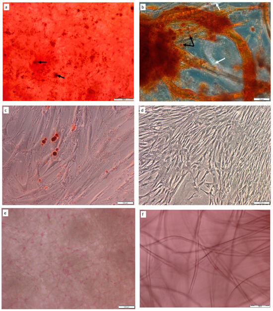 Osteogenic Potential of Human Dental Pulp Stem Cells (hDPSCs) Growing ...