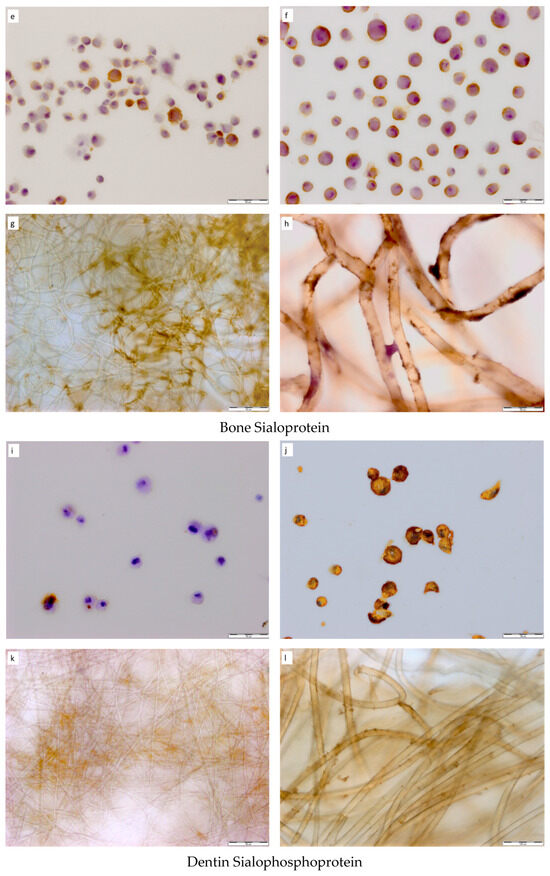 Osteogenic Potential of Human Dental Pulp Stem Cells (hDPSCs) Growing ...