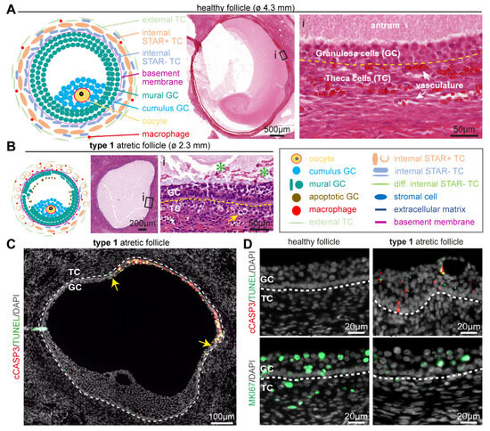Classification of Atretic Small Antral Follicles in the Human Ovary