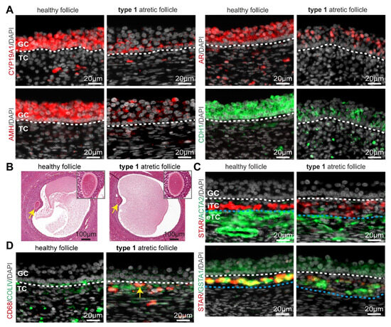 Classification of Atretic Small Antral Follicles in the Human Ovary