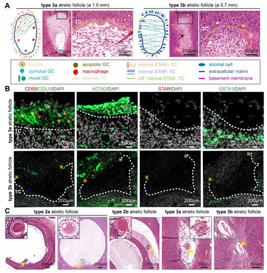 Classification of Atretic Small Antral Follicles in the Human Ovary