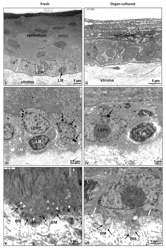 Influence of Organ Culture on the Characteristics of the Human Limbal ...