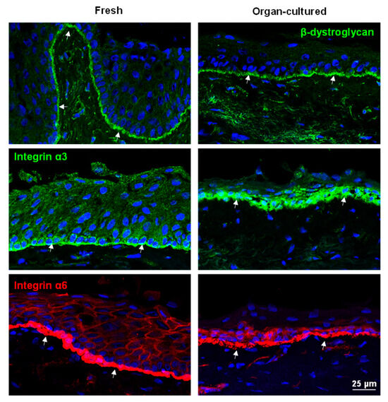 Influence of Organ Culture on the Characteristics of the Human Limbal ...