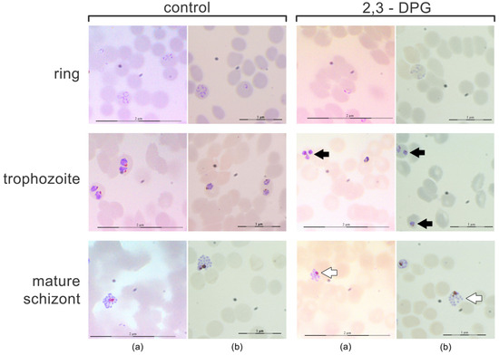 Differential Gene Expression of Malaria Parasite in Response to Red ...