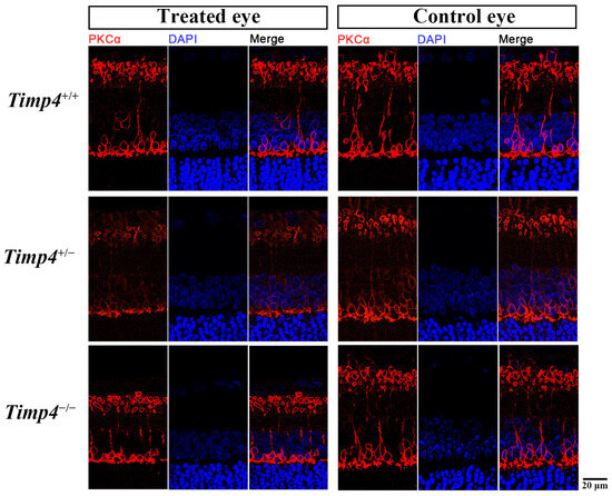 Defect of TIMP4 Is Associated with High Myopia and Participates in Rat ...