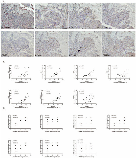Predictive Roles of ADAM17 in Patient Survival and Immune Cell ...