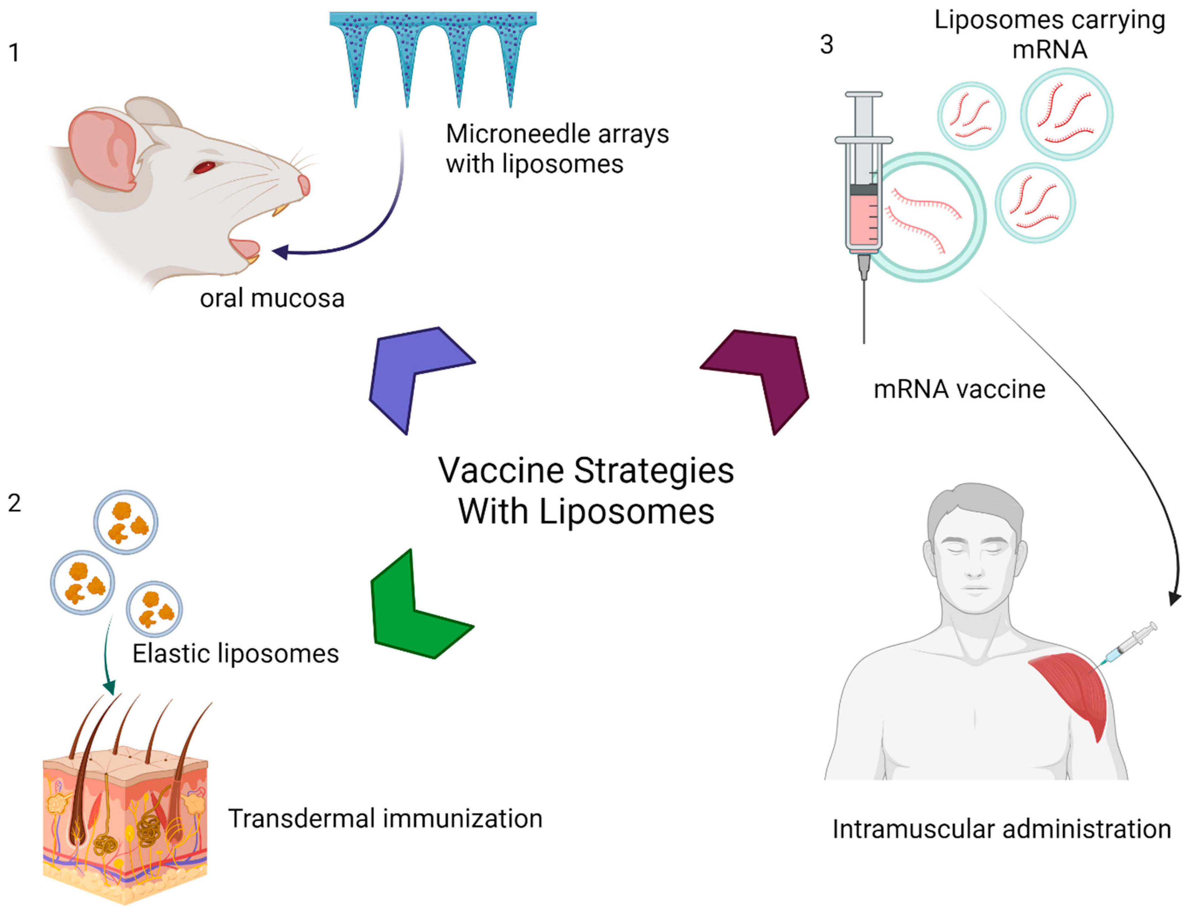 Extracellular Vesicles as Delivery Systems in Disease Therapy