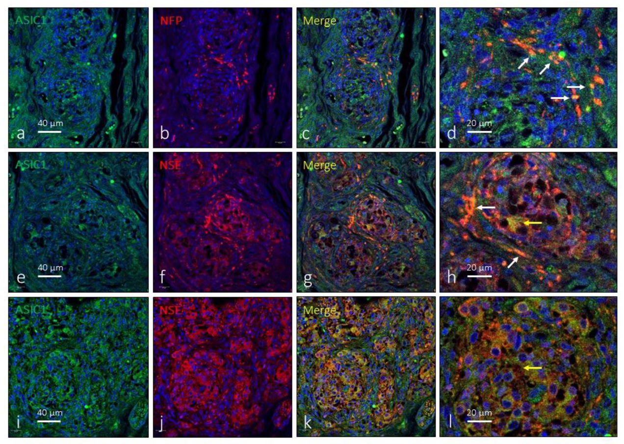 Acid-Sensing Ion Channels’ Immunoreactivity in Nerve Profiles and ...