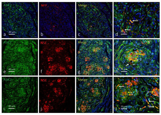 Acid-Sensing Ion Channels’ Immunoreactivity in Nerve Profiles and ...