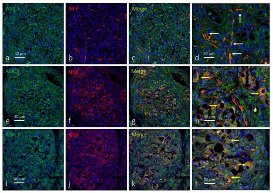 Acid-Sensing Ion Channels’ Immunoreactivity in Nerve Profiles and ...