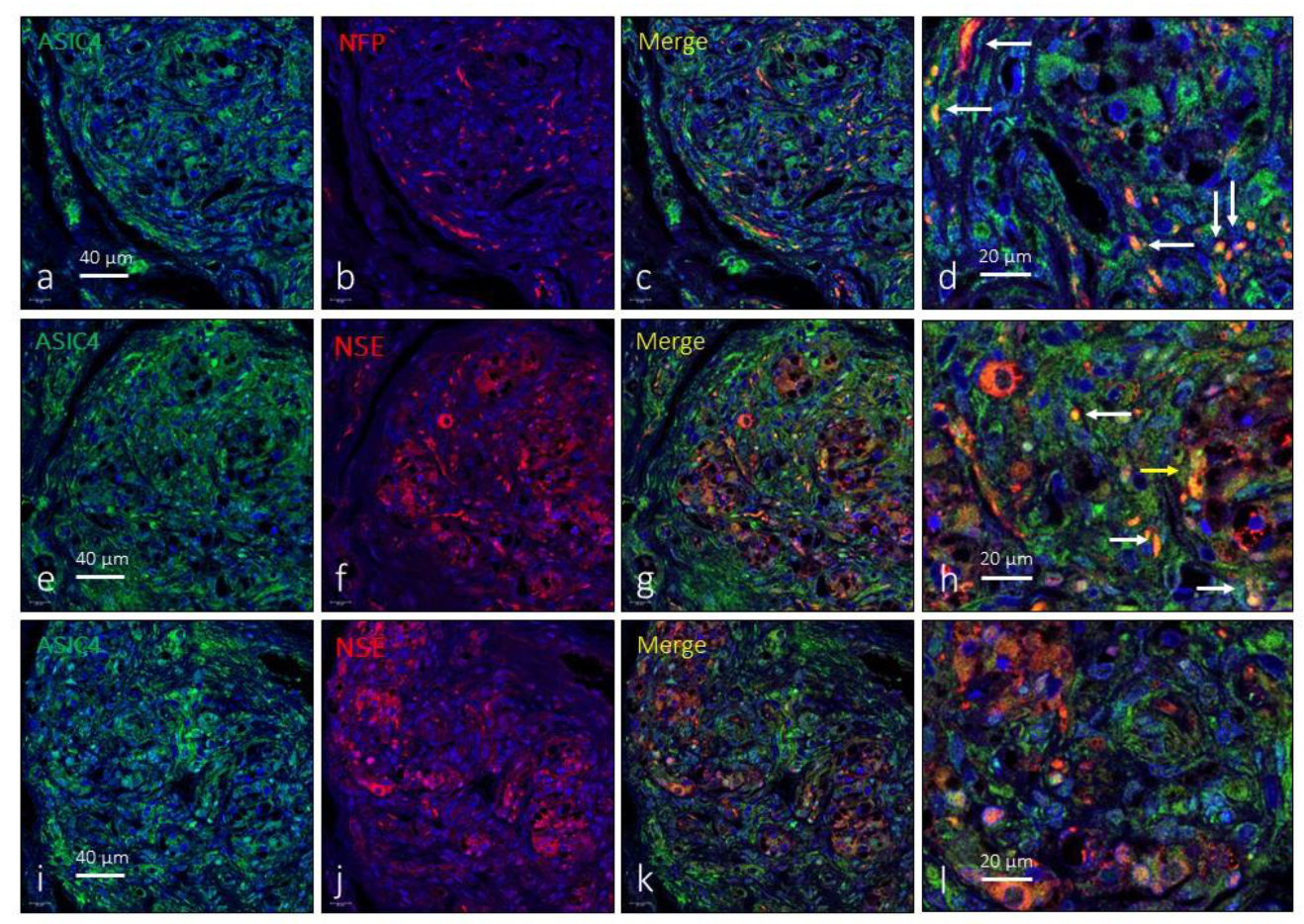 Acid-Sensing Ion Channels’ Immunoreactivity in Nerve Profiles and ...