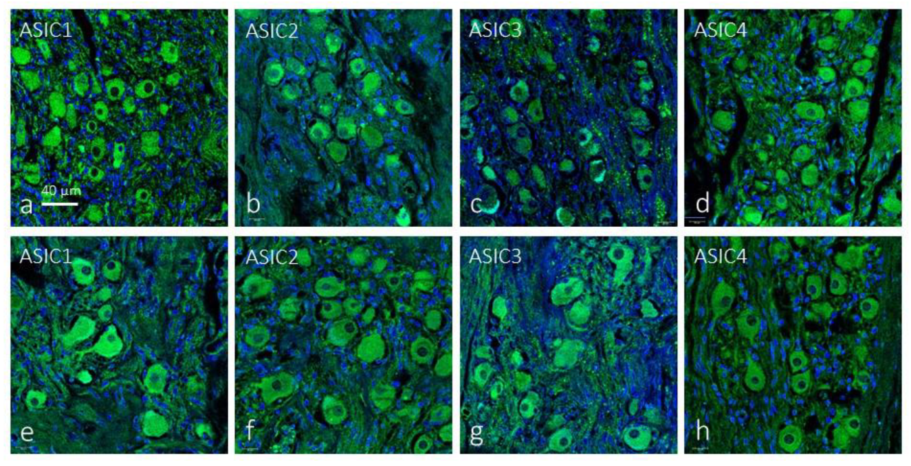 Acid-Sensing Ion Channels’ Immunoreactivity in Nerve Profiles and ...